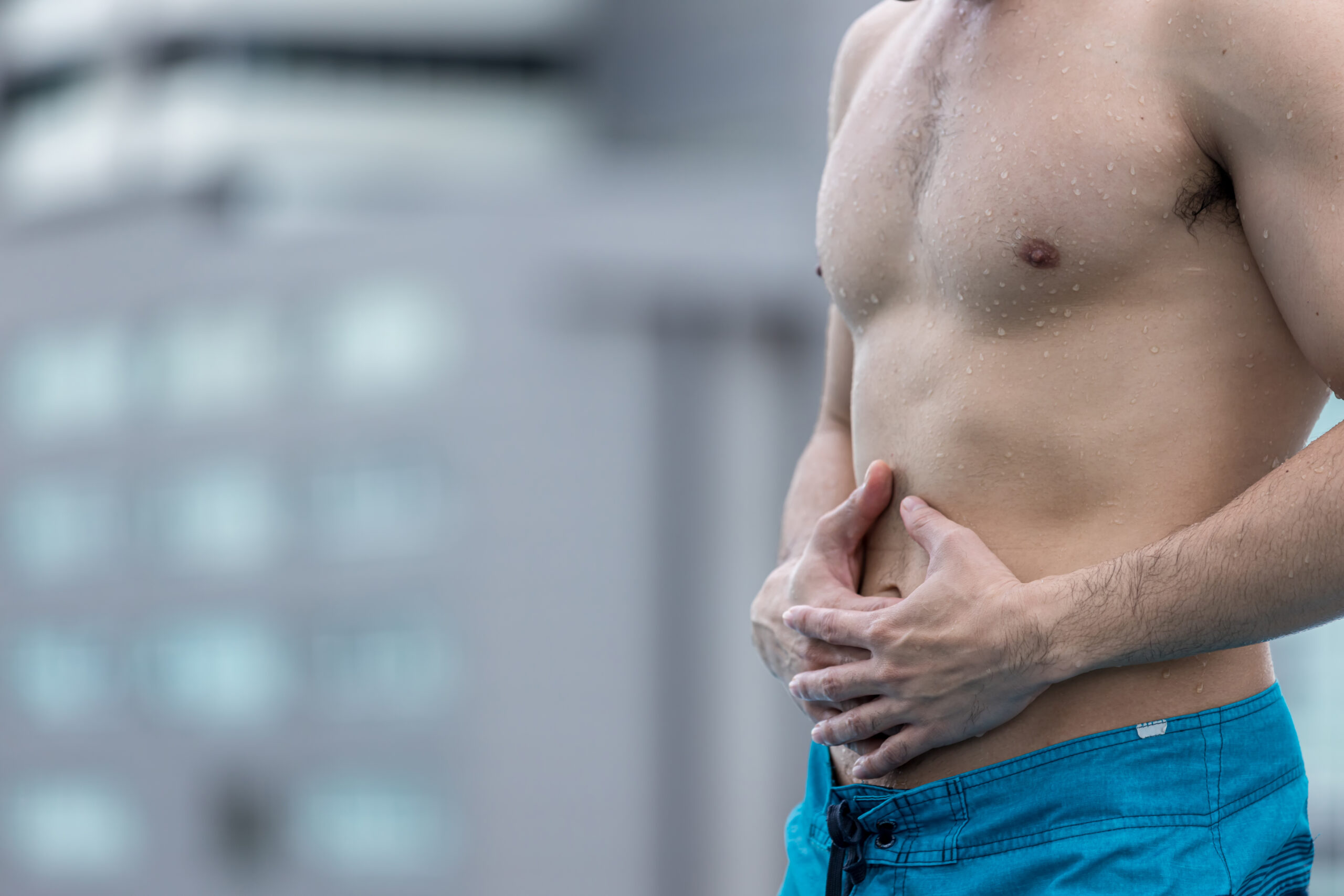 Hernia Umbilical - Doctor González