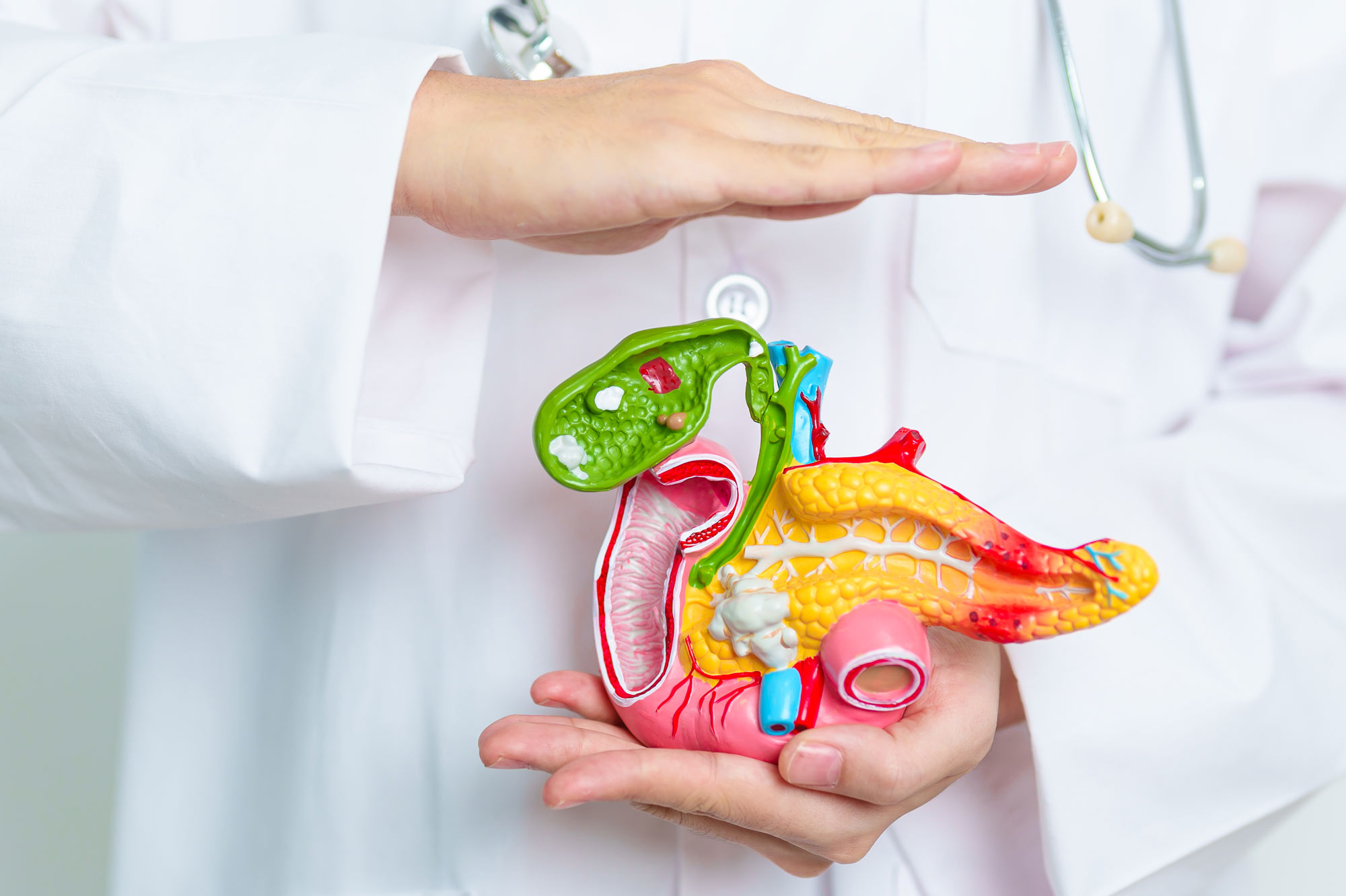 Pancreatitis aguda: causas y manejo inicial - Doctor González